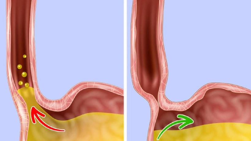 Dar Kot Pantolonlar Sağlığınızı Etkileyebilir! Bütün Gün Pantolon Giyerseniz Ne Olur?